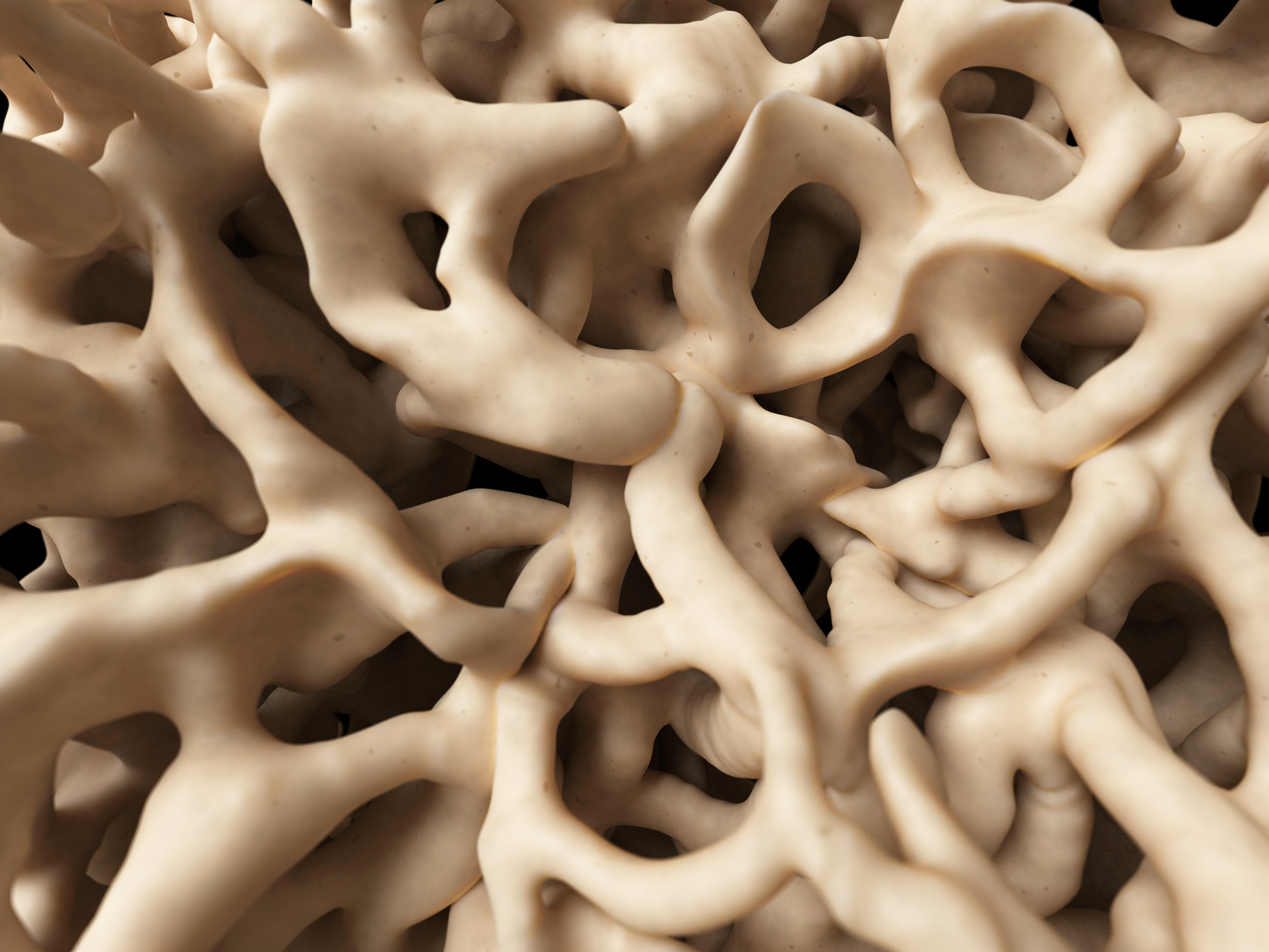 IMPLANT INFORMATION About Hard Tissue Bone THE IMPLANT REGISTER