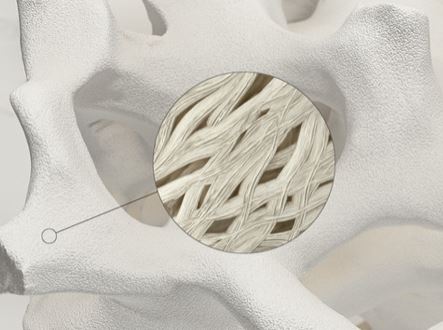 Orthoss® – THE IMPLANT REGISTER