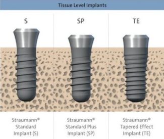 Straumann® Tissue Level Implants – THE IMPLANT REGISTER