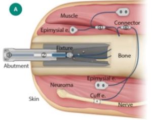 Integrum - THE IMPLANT REGISTER